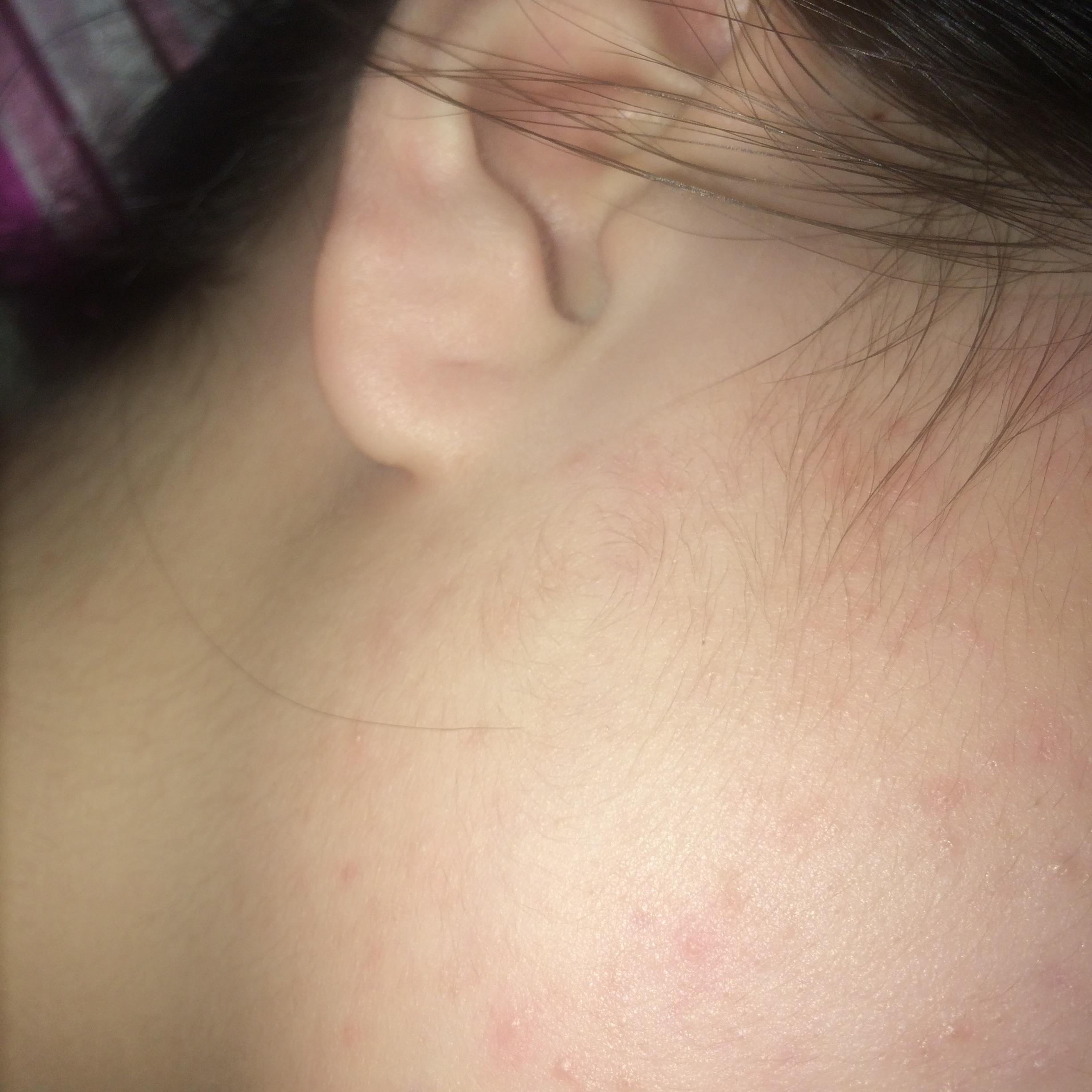 Weird Bumps On Skin
