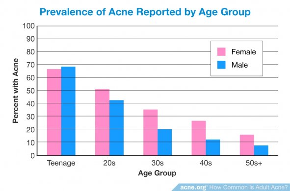 How Common Is Adult Acne