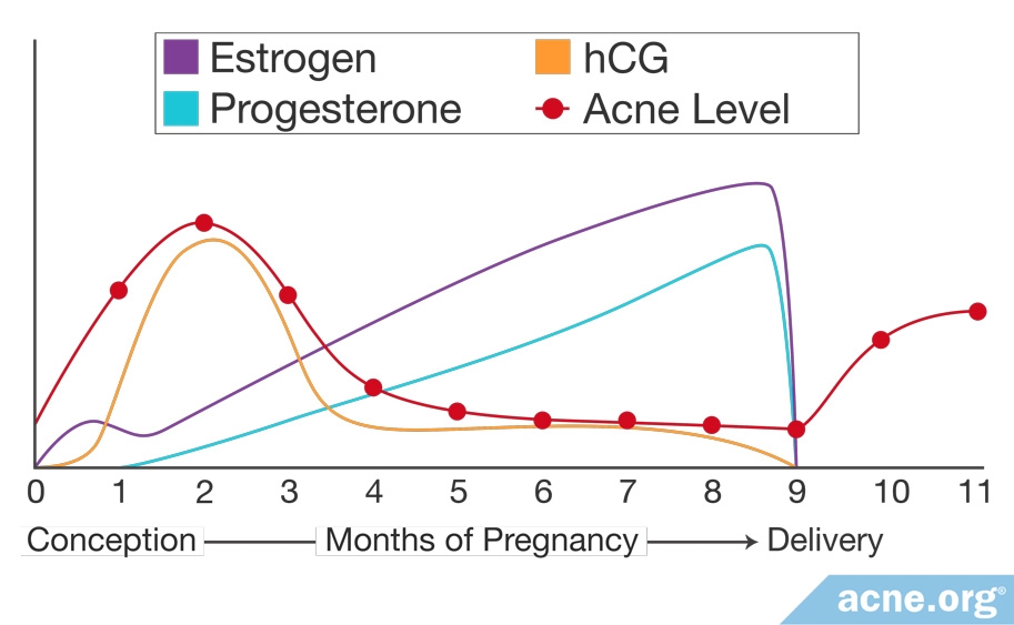 Women And Female Acne